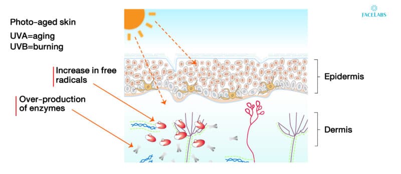 Photoaging ผิวแก่...แดด - FACELABS THAILAND